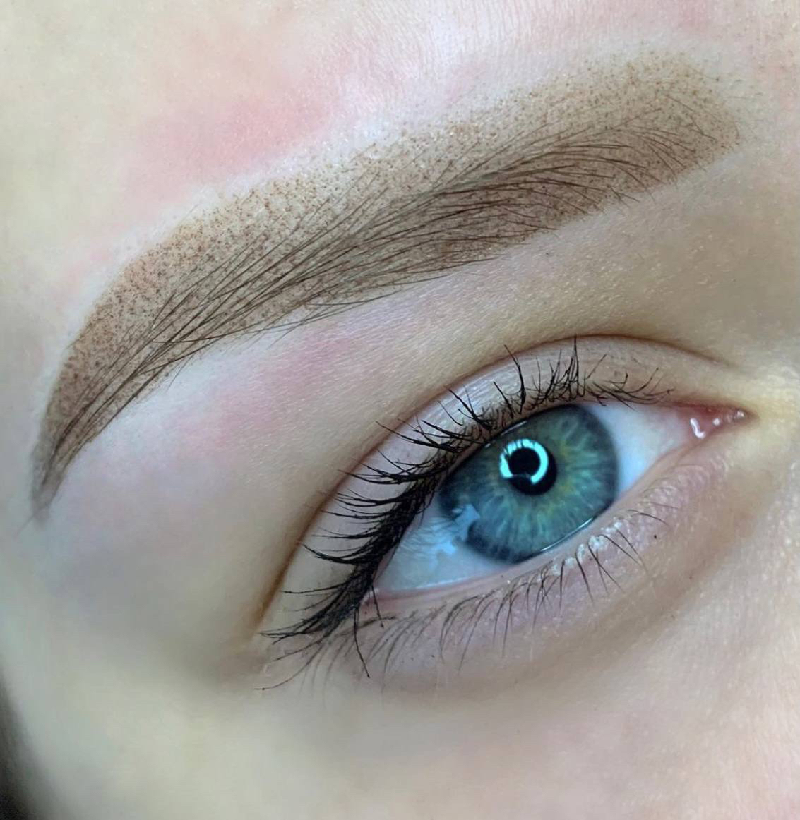 טיפול מיקרושיידינג - Hanit Cohen